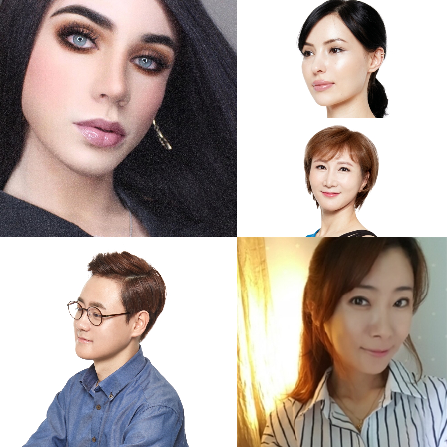 Endotine forehead lift in Korea - reduces wrinkles for youthful look